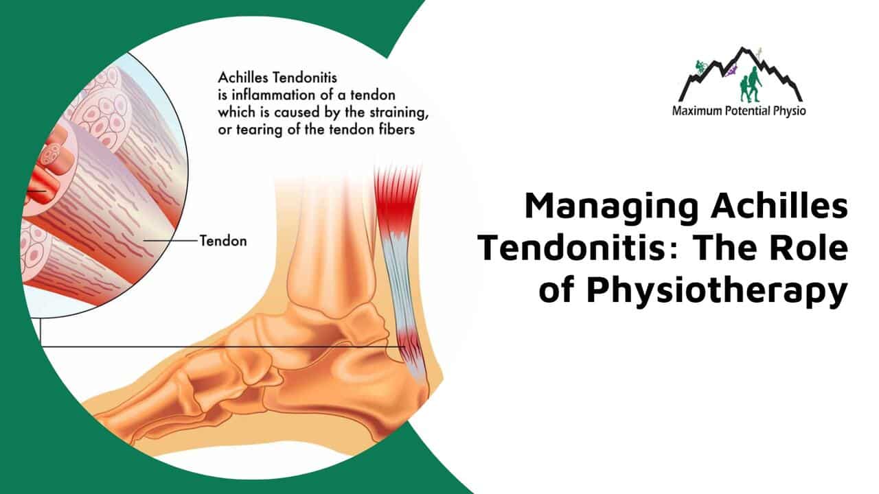 Achilles Tendonitis Causes Symptoms Treatment
