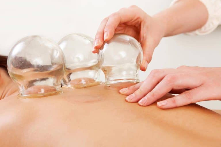 Rejuvenate Your Body and Mind: Benefits of Cupping Therapy - Maximum ...